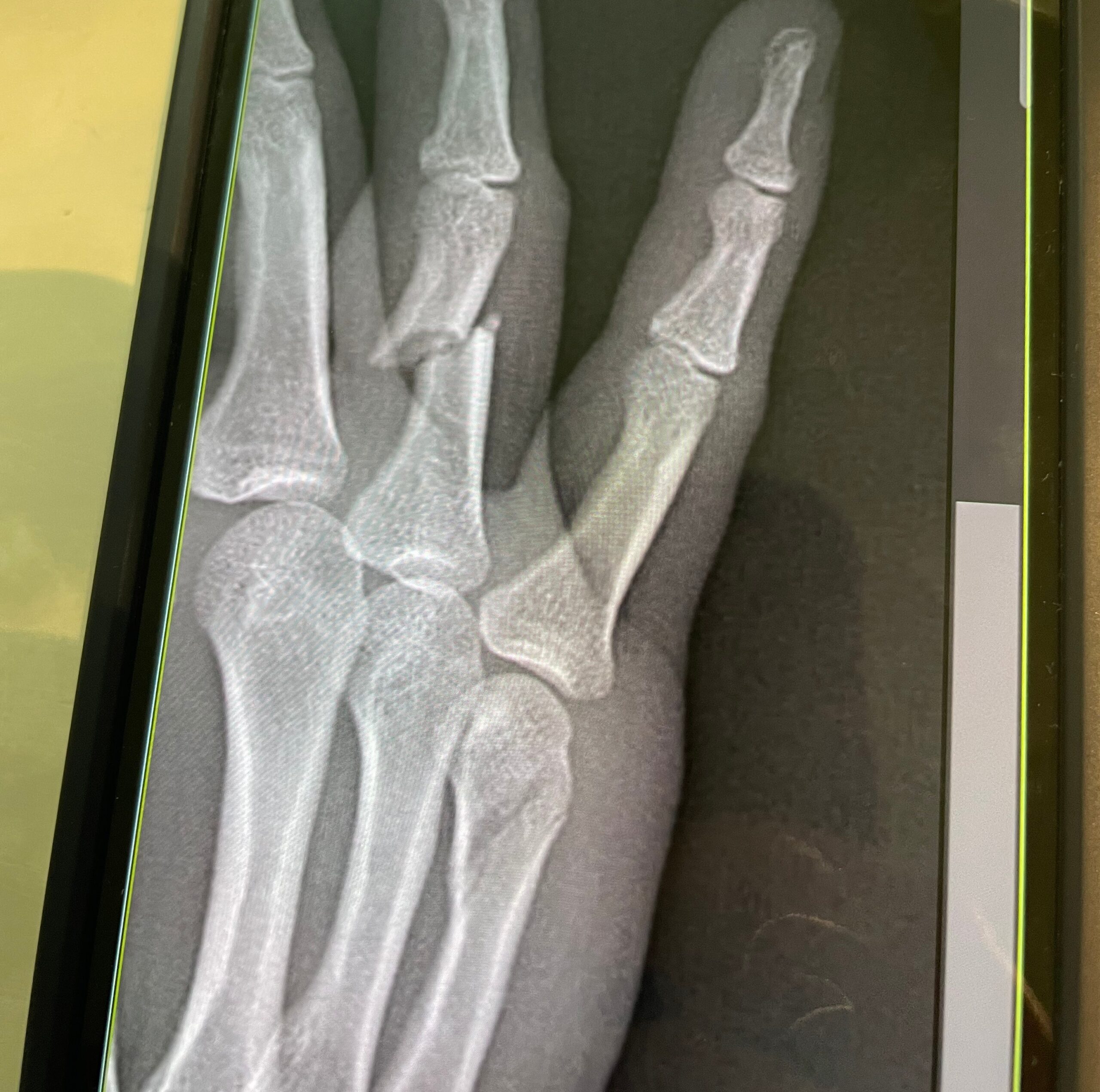 Blair's World Triathlon Championship Race Report - Roadkill Racing